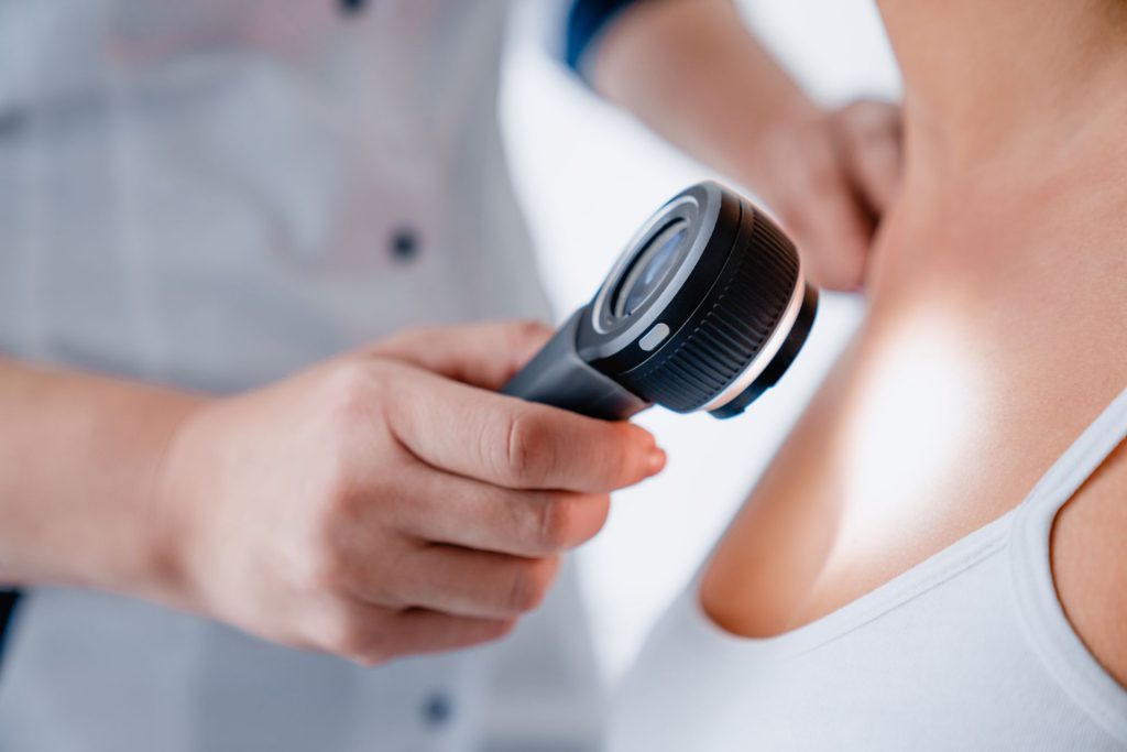 Skin Cancer Screenings in Toledo, OH | Nahhas Dermatology